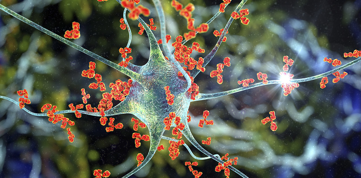 Malattie Rare, Tra Nuove Cure E Diritti Dei Malati: A Che Punto Siamo ...